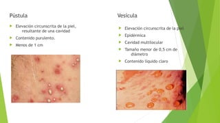 Lesiones dermatológicas | ODP
