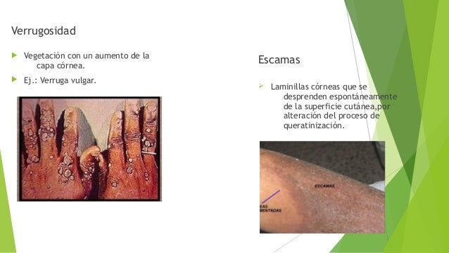 Lesiones dermatológicas