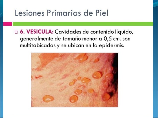 Lesiones dermatológicas básicas