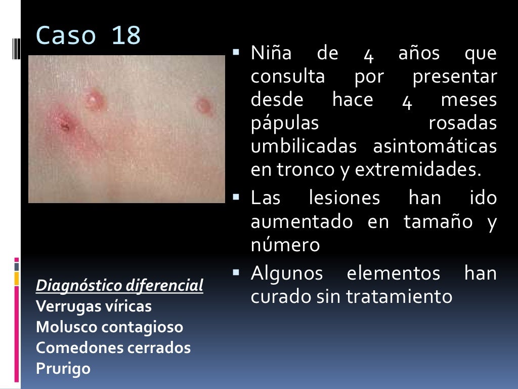 Lesiones dermatológicas en pediatría