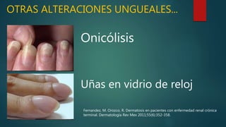 Lesiones Dermatológicas En Pacientes Con Enfermedad Renal | PPTX