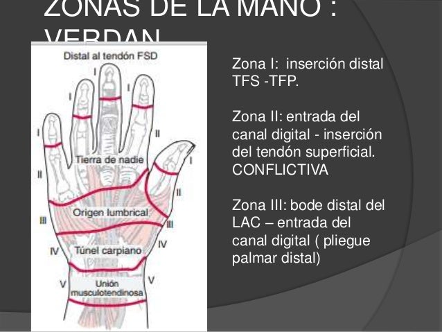 Lesiones de tendones flexores