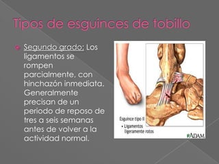 Lesiones de tobillo | PPTX