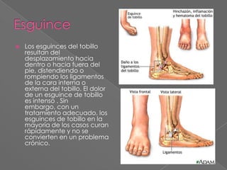 Lesiones de tobillo | PPTX