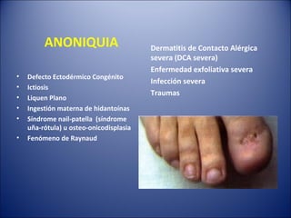 Lesiones de uñas | PPT