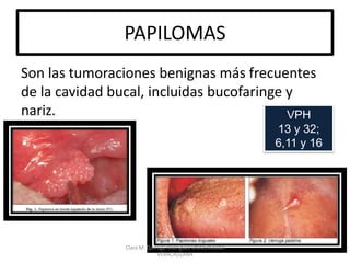 Lesiones diversas de la cavidad bucal | PPTX