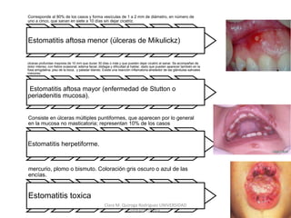 Lesiones diversas de la cavidad bucal | PPTX