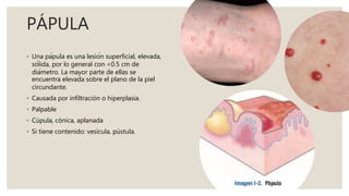 Lesiones elementales de la piel | PPTX