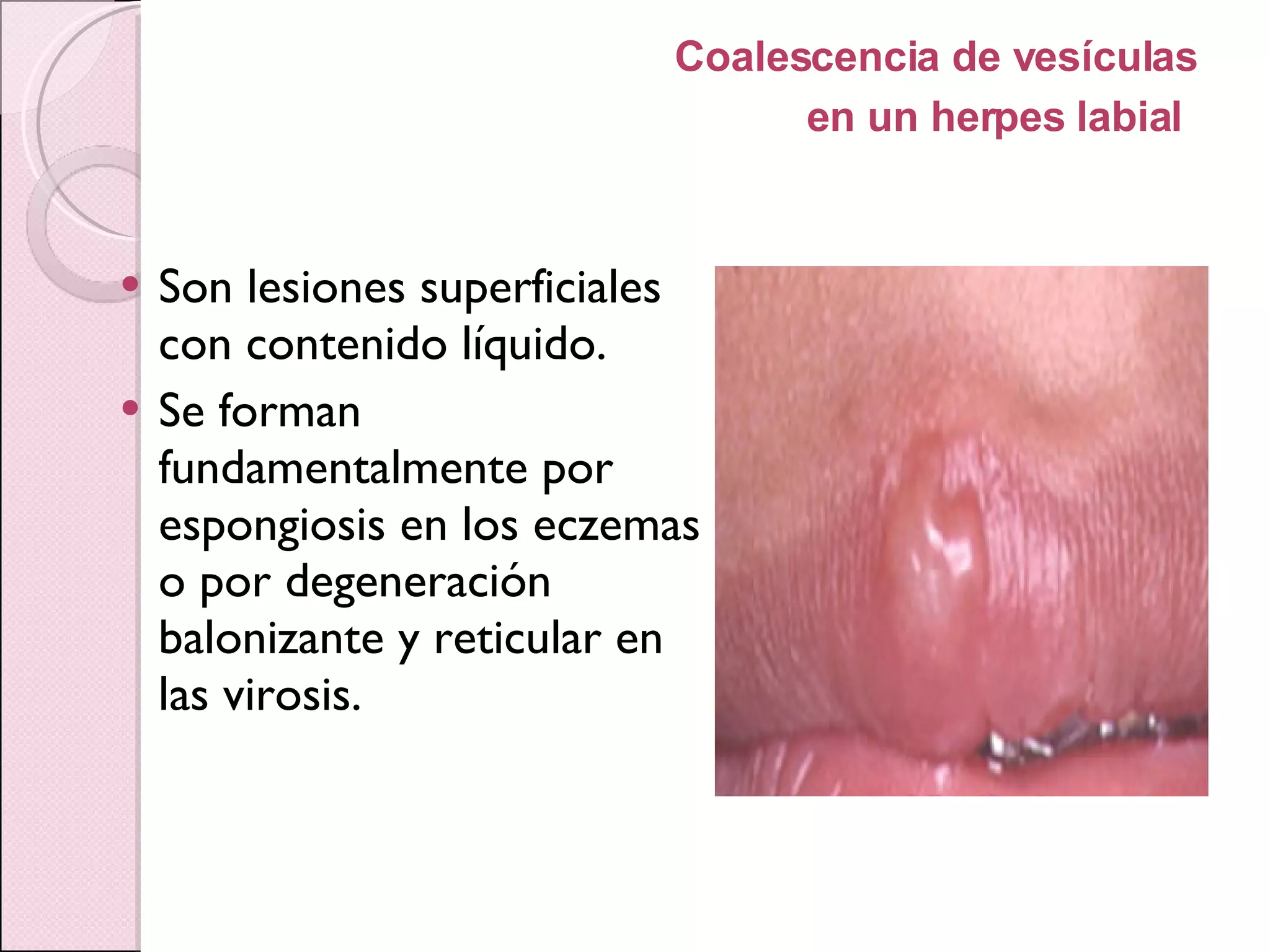 Lesiones Elementales patologia bucal | PPT