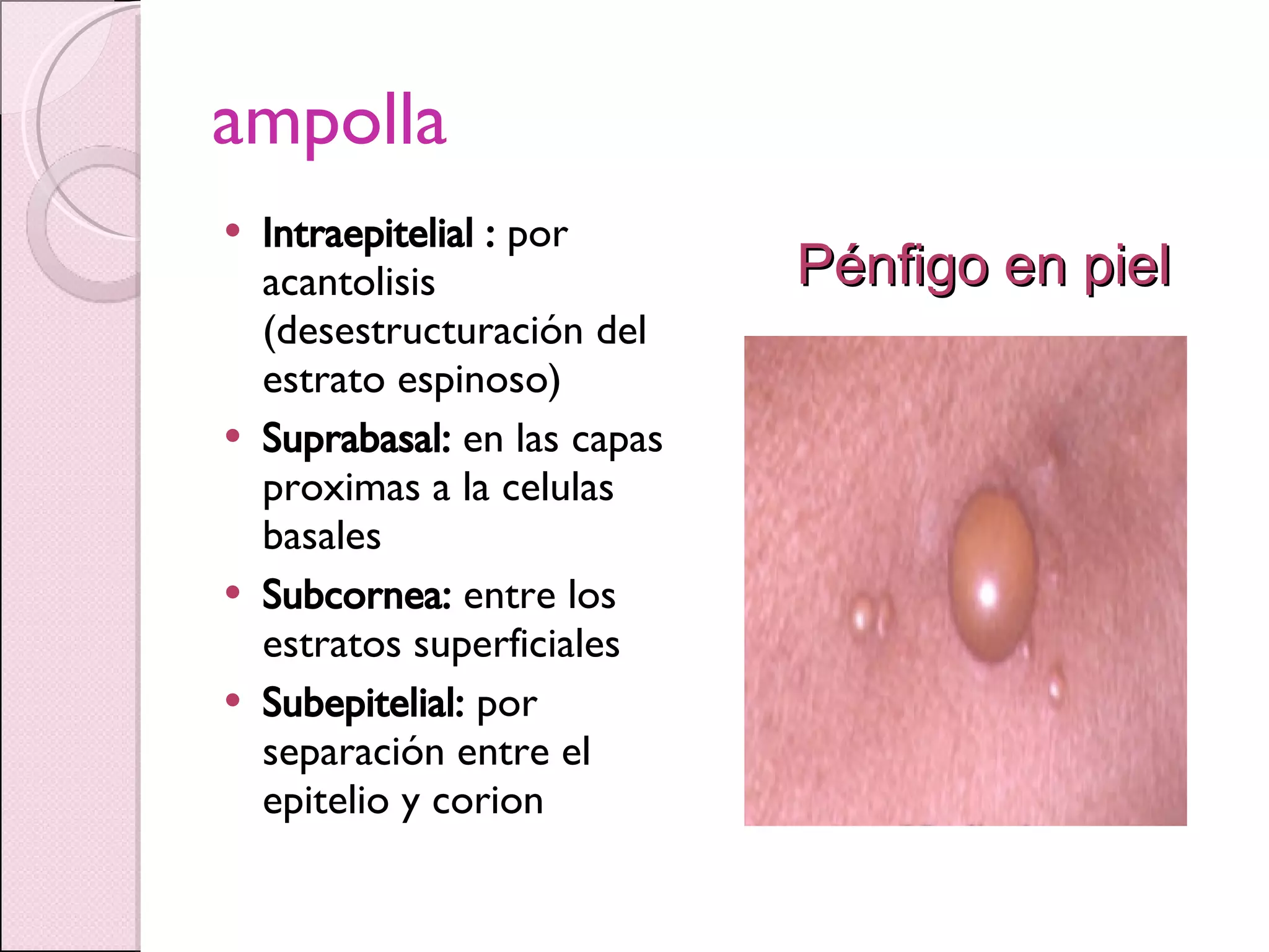 Lesiones Elementales patologia bucal | PPT