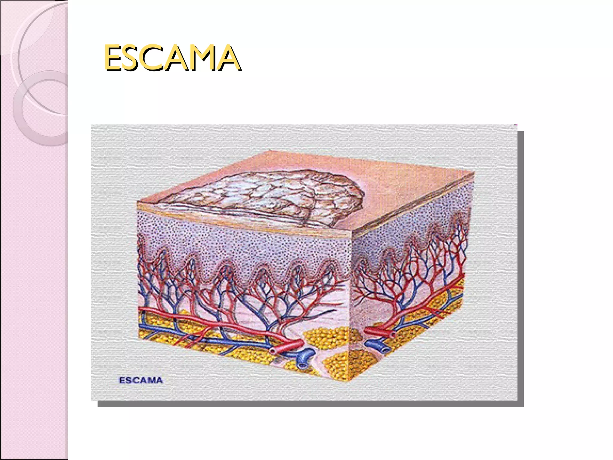 Lesiones Elementales patologia bucal | PPT