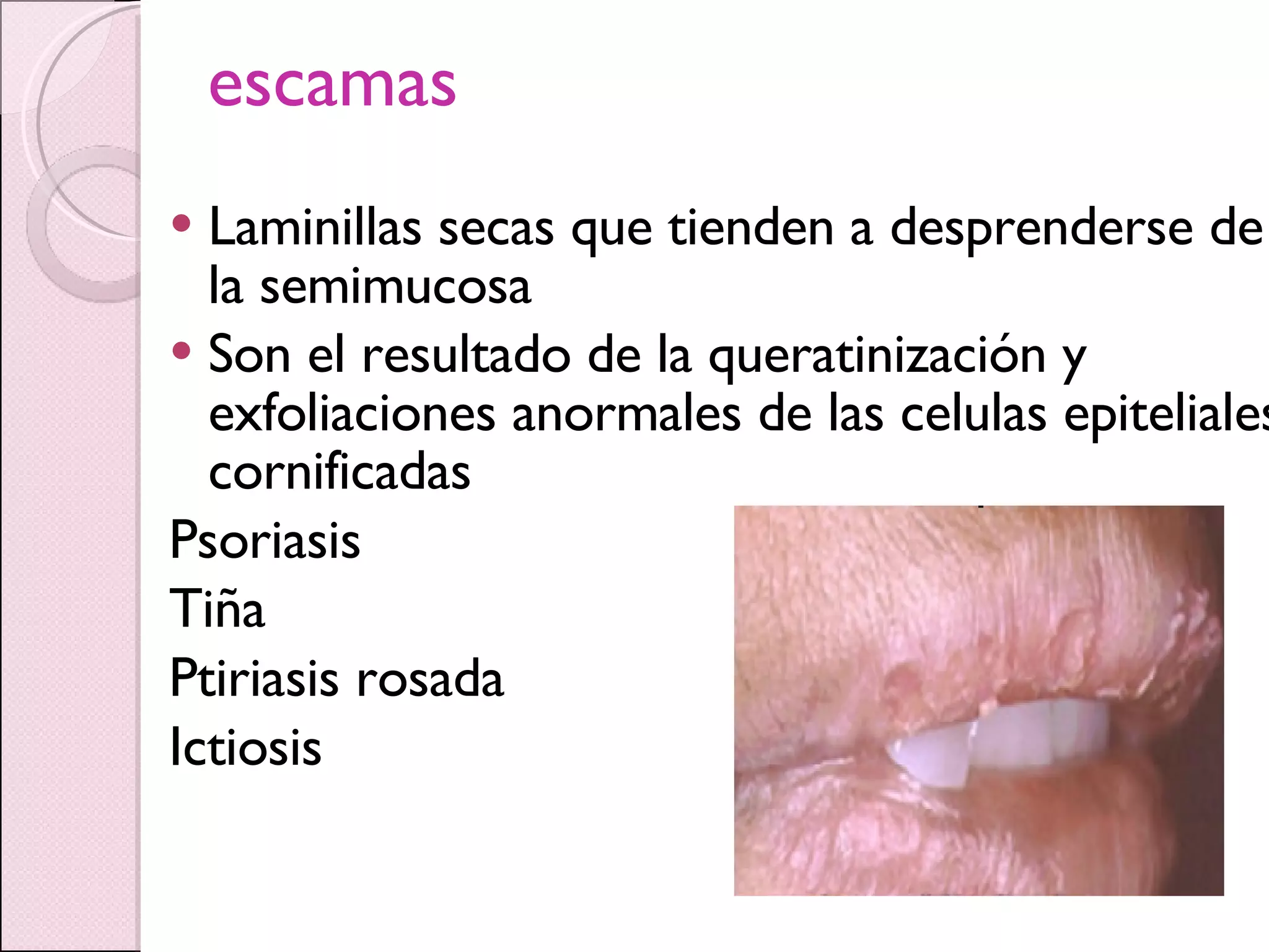 Lesiones Elementales patologia bucal | PPT