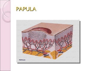Lesiones Elementales patologia bucal | PPT