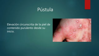 Lesiones elementales primarias | PPTX