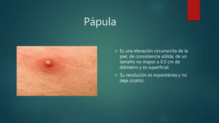 Lesiones elementales primarias | PPTX