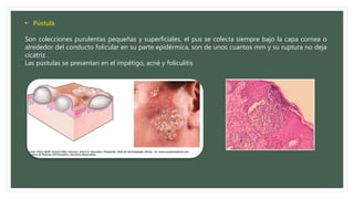 Lesiones elementales | PPTX
