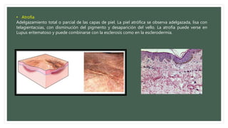 Lesiones elementales | PPTX