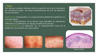 Lesiones elementales | PPTX
