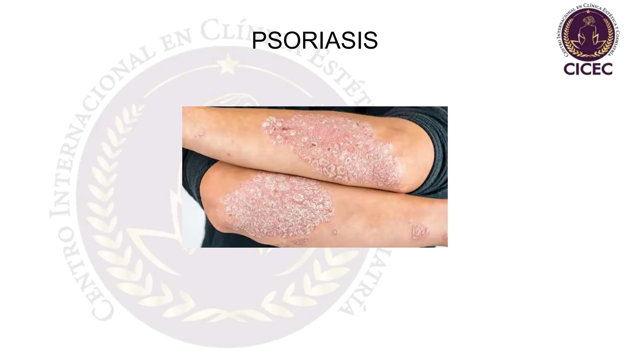 Lesiones elementales primarias y secundarias dermatológicas.pptx