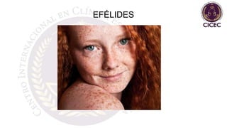 Lesiones elementales primarias y secundarias dermatológicas.pptx