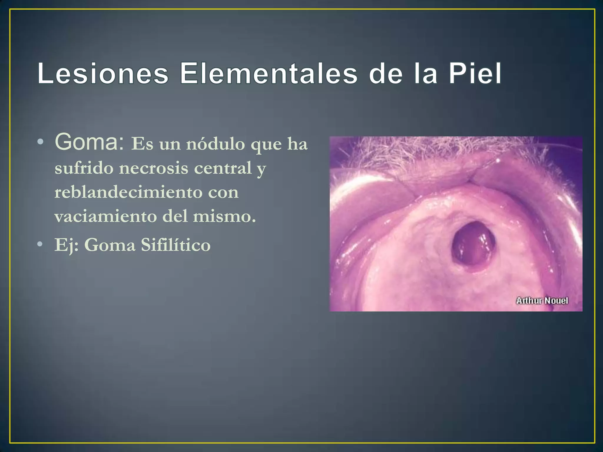 Lesiones elementales de la piel | PPTX