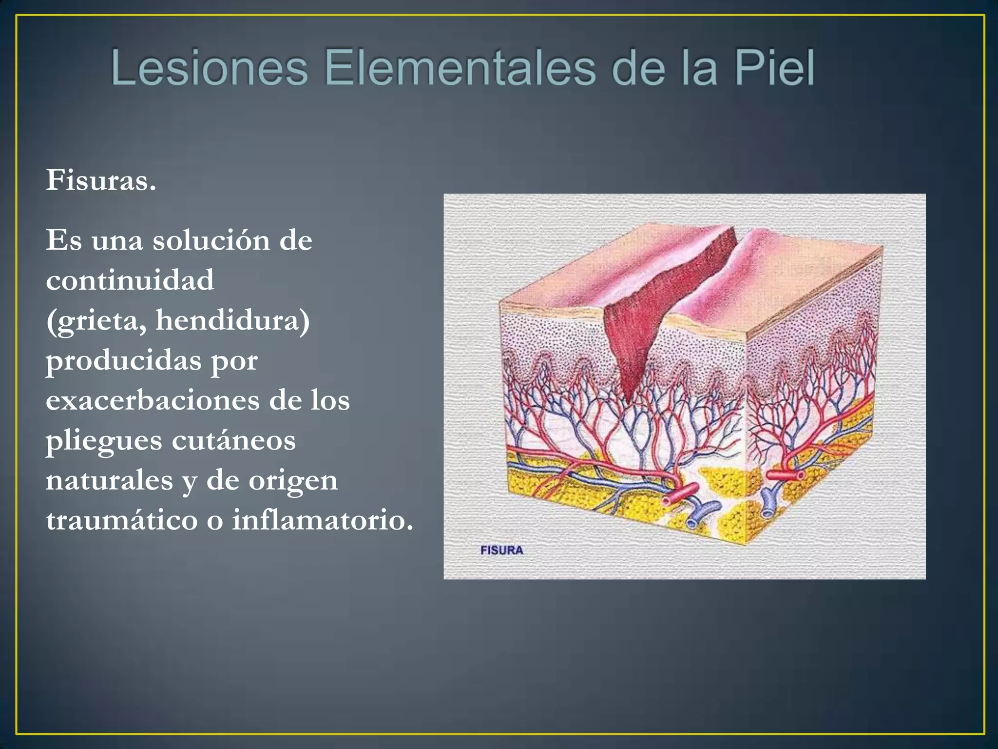 Lesiones Elementales De La Piel Pptx