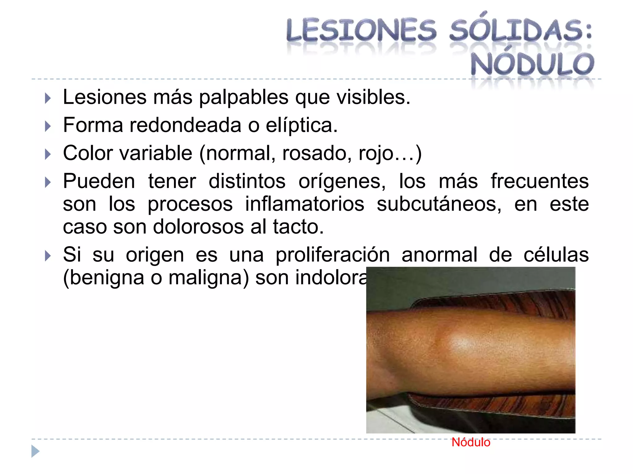 Lesiones elementales de la piel | PPTX | Skin and Dermatology ...