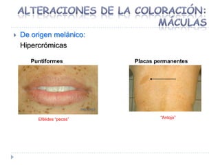 Lesiones elementales de la piel | PPTX