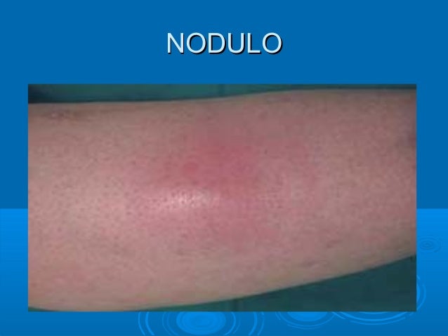 Lesiones elementales de la piel