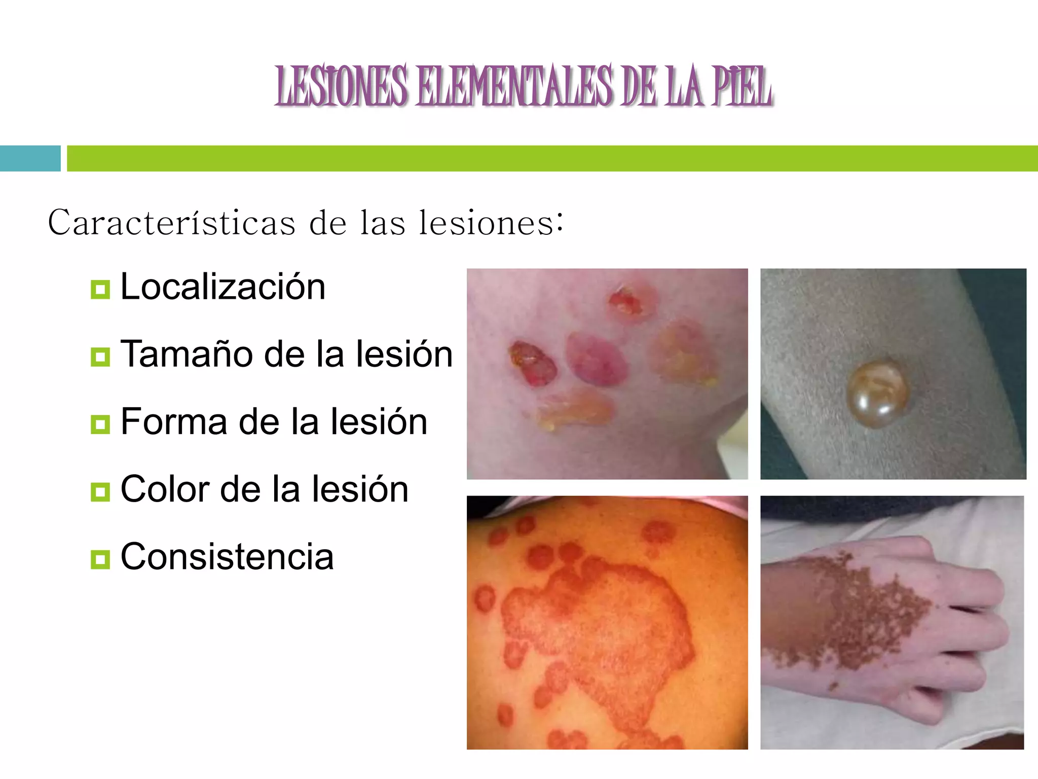Lesiones elementales de la piel. PRIMARIAS Y SECUNDARIAS. | PPTX
