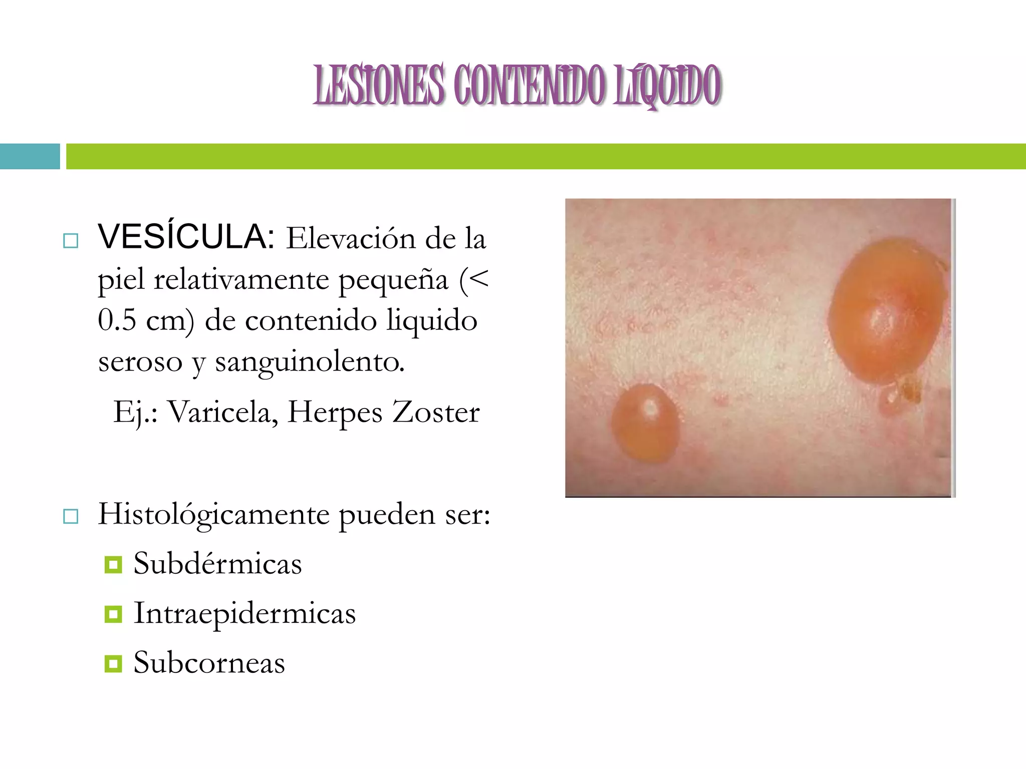 Lesiones elementales de la piel. PRIMARIAS Y SECUNDARIAS.