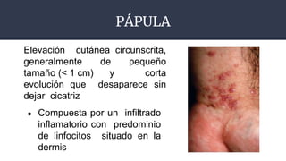 Lesiones elementales de la piel.pptx