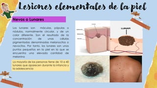 Lesiones elementales de la piel (1).pptx