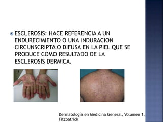 Lesiones elementales de la piel | PPTX