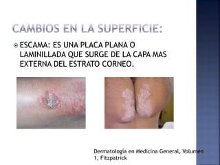 Lesiones elementales de la piel | PPTX