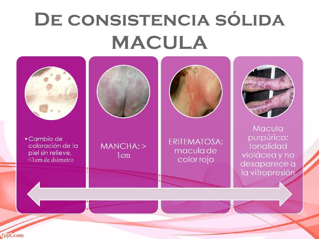 Lesiones elementales dermatológicas