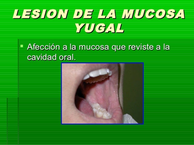 Lesiones Elementales En La Cavidad Bucal