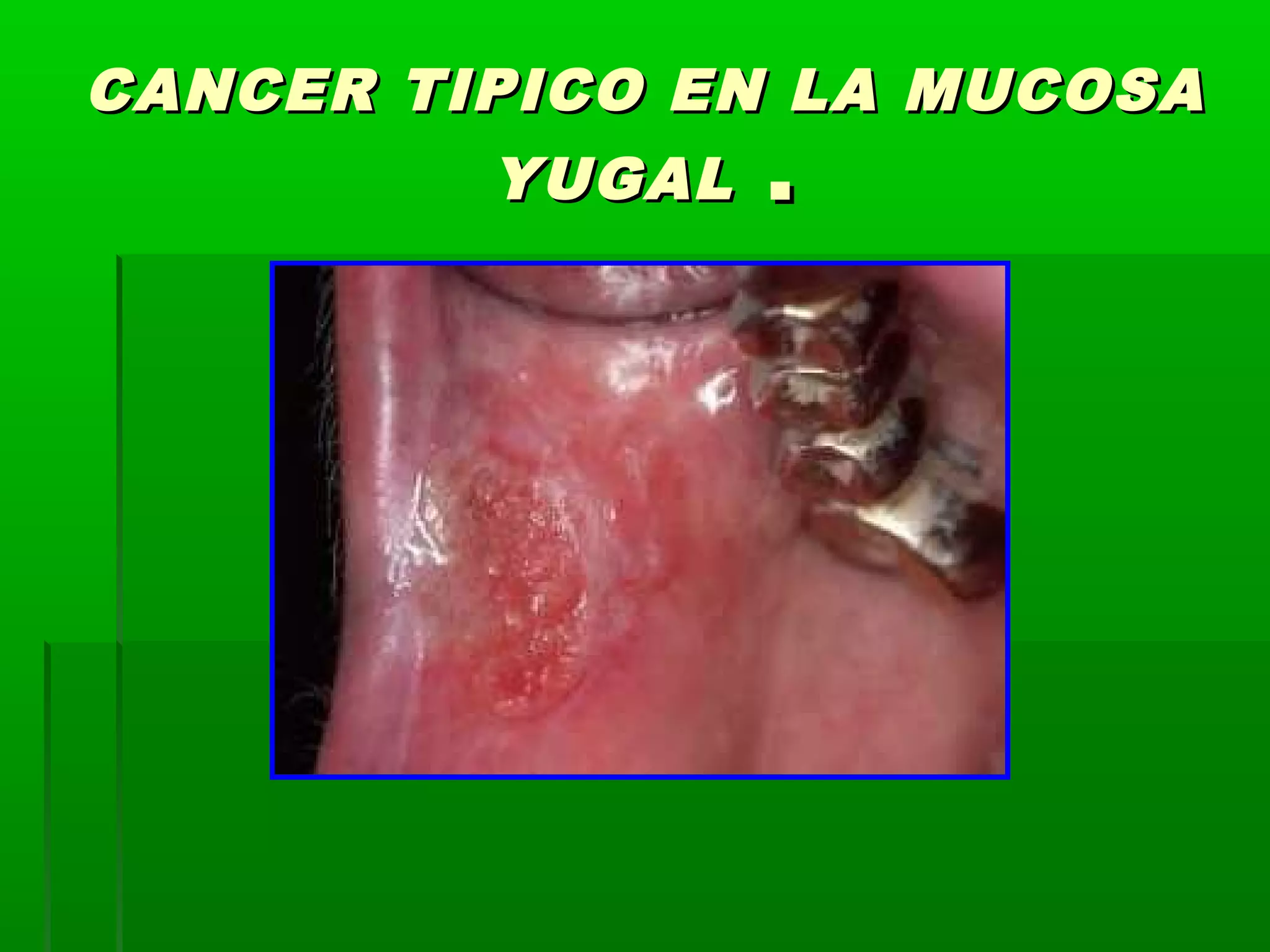 Lesiones elementales en la cavidad bucal | PPT