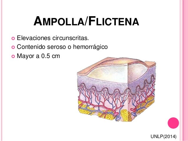 Lesiones elementales primarias
