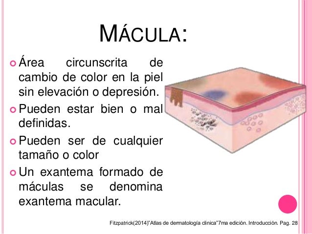 Lesiones elementales primarias