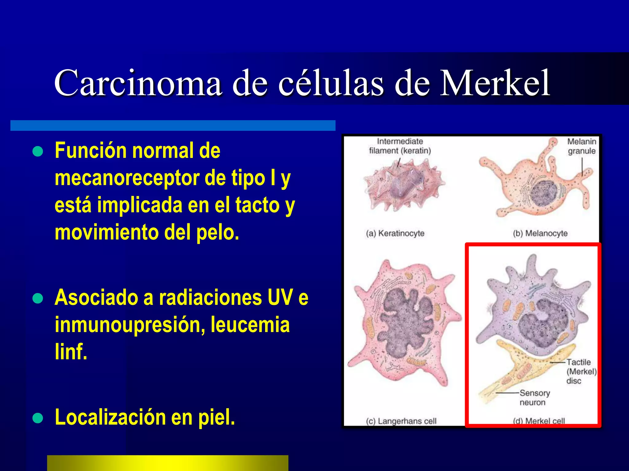 LESIONES EPIDERMICAS MALIGNAS - CANCER DE PIEL | PPTX