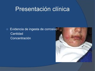 Lesiones esofagica por caustico | PPTX