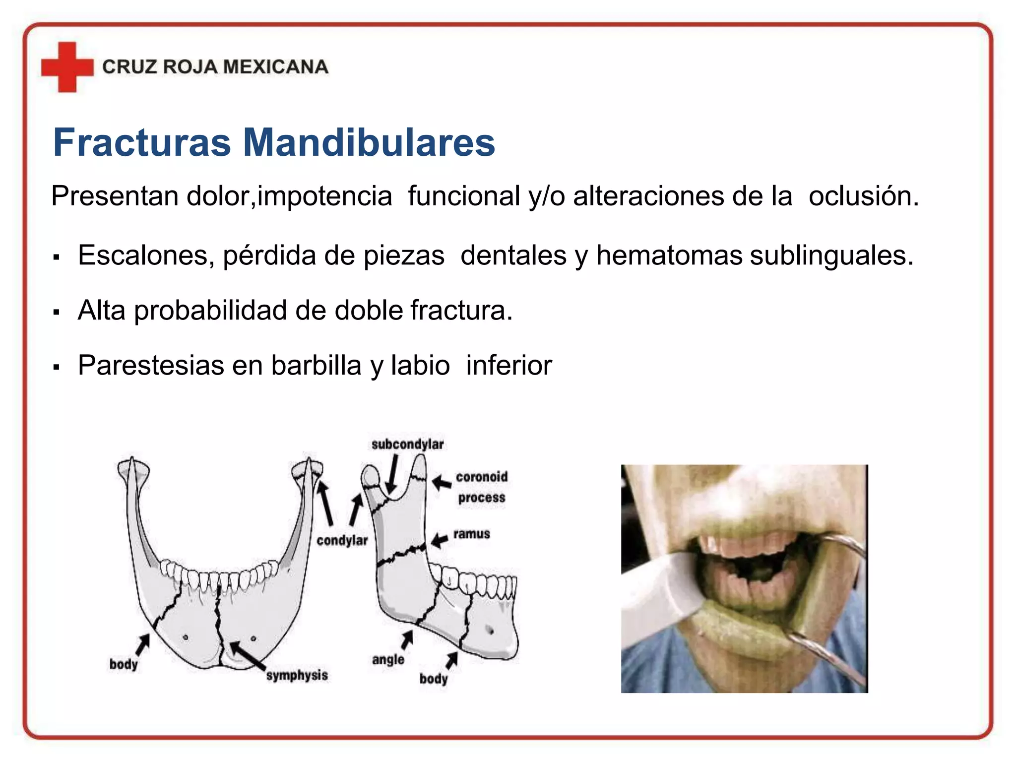 Lesiones faciales | PPT