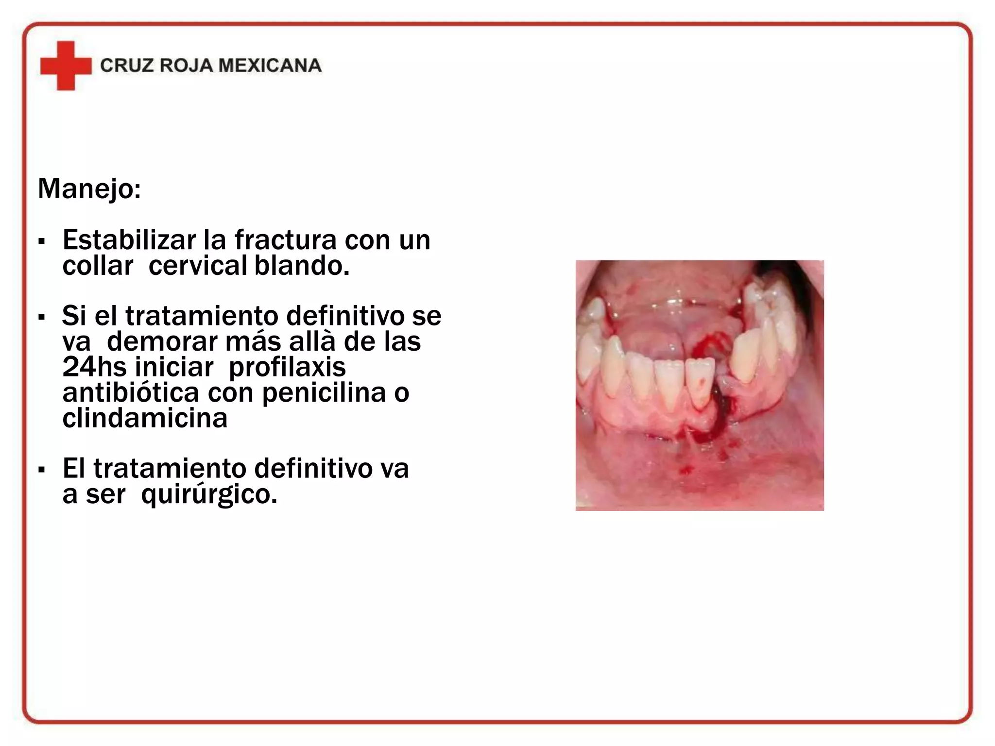 Lesiones faciales | PPT