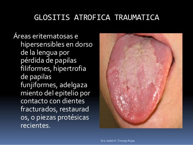 Lesiones fisicas y quimicas