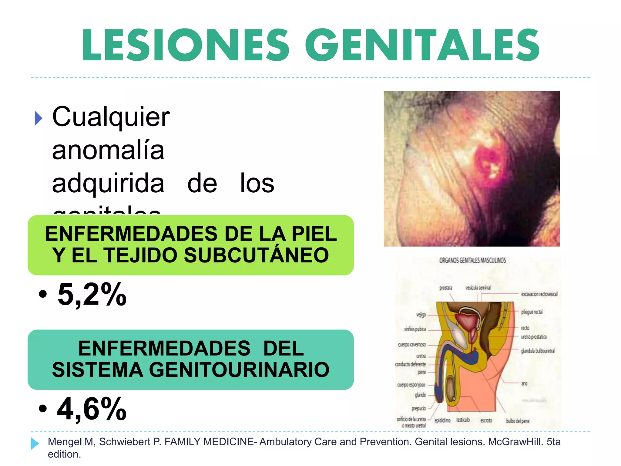 Lesiones genitales | PPTX