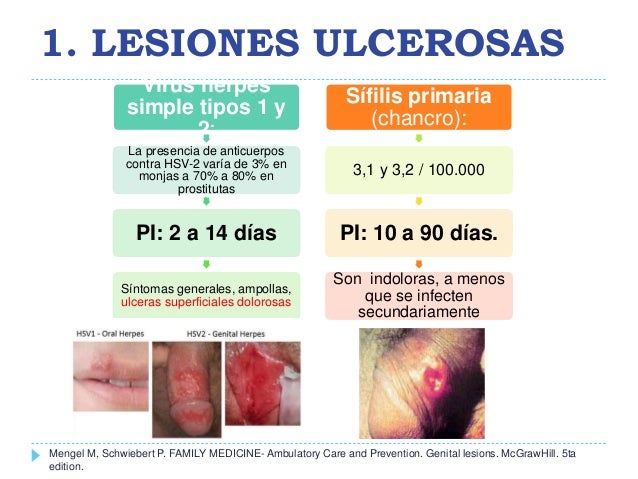 Lesiones genitales