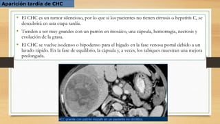 Lesiones hepaticas malignas | PPTX