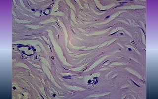 Lesiones hiperplasicas de tejido fibroso. rm m ayhuasca | PDF