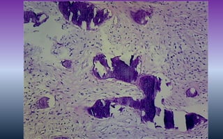 Lesiones hiperplasicas de tejido fibroso. rm m ayhuasca | PDF